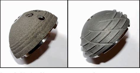 Figure 1 From Press Fit Versus Threaded Acetabular Cups In Total Hip
