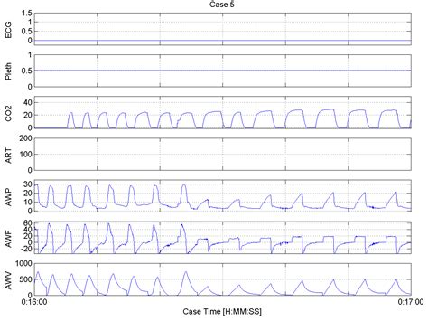 Case 5 Waveform Plots 60 Second Plots