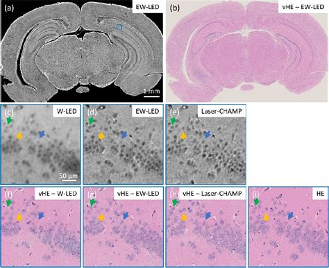 Figure 2 From Deep Learning Assisted Low Cost Autofluorescence