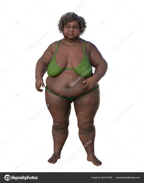 Obese African Woman