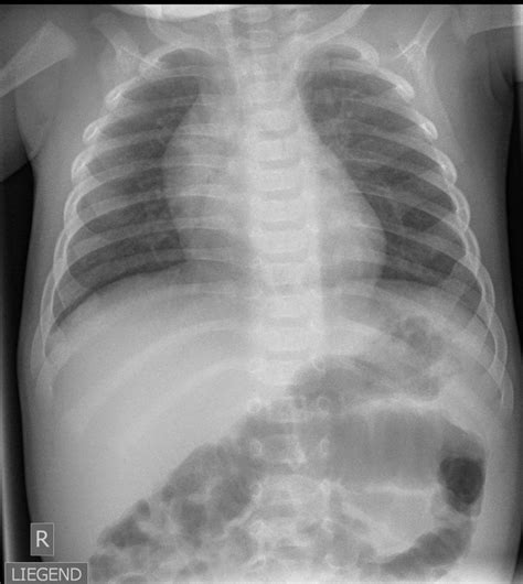 Thorax Arzt Orthorad