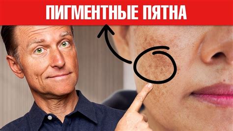 Дефицит ЭТОГО минерала вызывает возрастные пигментные пятна 🧐 Youtube