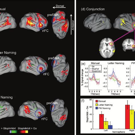 Pdf Common Neural Substrates For Inhibition Of Spoken And Manual
