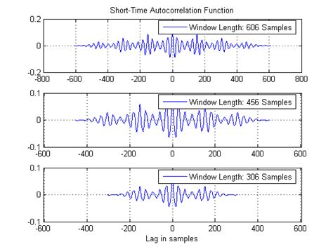 Speech Processing Using Matlab Part 1