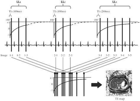 Modified Look Locker Inversion Recovery Molli Pulse Sequence With Download Scientific Diagram