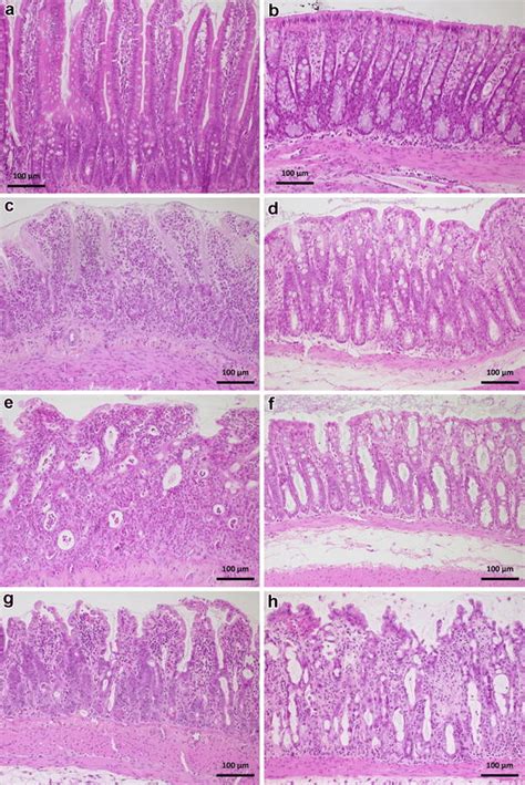 Jejunum Histology Histology Laboratory Manual