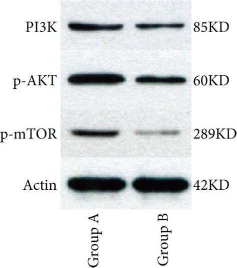 Expression Of Pi K P Akt And P Mtor In Rat Penis A The Light Blue Download Scientific