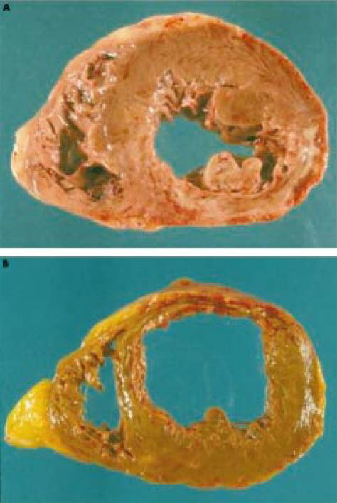 Demonstration Of Apoptosis A Labelling Of Nuclear Dna Fragmentation