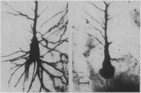 Age Related Loss Of Fractal Structure In The Dendritic Arbor Of The