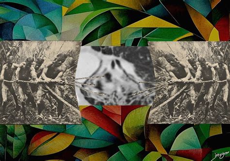 Finding Lungs Traction Bronchiectasis The Common Vein