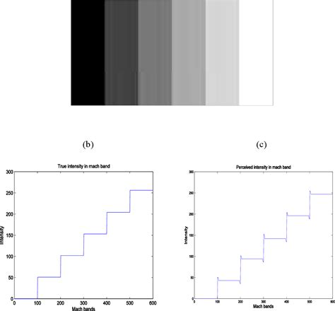 Figure From An Automated Segmentation Of Retinal Images For Use In Diabetic Retinopathy