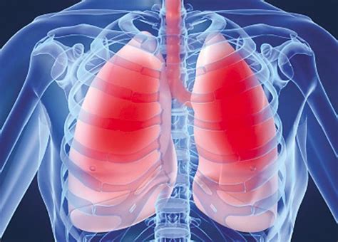 Tb Screening Drive In Up Found To Be Unaware Of Their Tb Status Hindustan Times