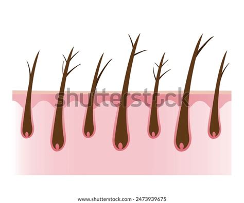 Cross Section Damaged Types Split Ends Stock Vector Royalty Free 2473939675 Shutterstock