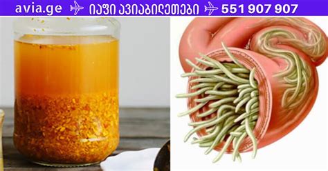 მოიშორეთ ნებისმიერი ინფექცია და მოკალი ყველა პარაზიტი ამ ანტიბიოტიკური სასწაულით Vap Ge