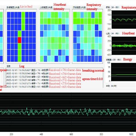 Real Time Sleepmatrix Monitoring Results Download Scientific Diagram