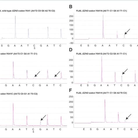 Ezh2 Mutation In Follicular Lymphomas Fl By Bcl2 Status Ezh2