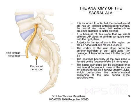 Technique Of Percutaneous Iliosacral Screw Fixation Of Sacroiliac Disruptions With The Patient