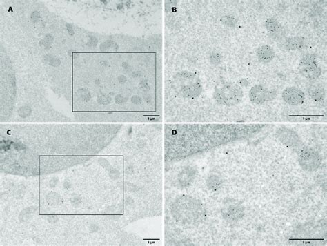 Electron Micrographs Of Dual Immunogold Labelling In Transfected Download Scientific Diagram