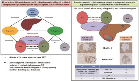 Synchronous Double Primary Combined Hepatocellular Cholangiocarcinoma