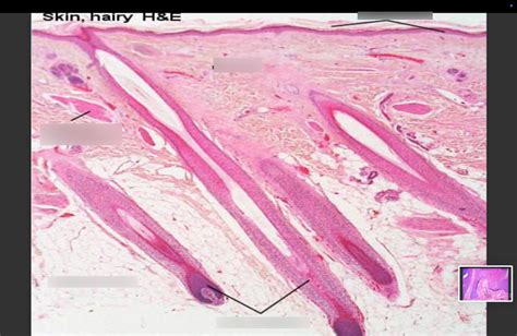 Dermis And Hypodermis Features Diagram Quizlet