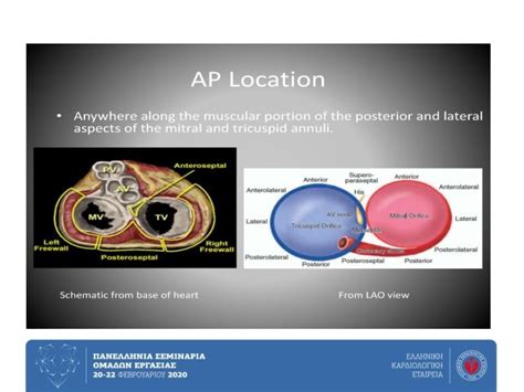 St Georges Algorithm Aha Guidelines Sc Guidelines Aperp