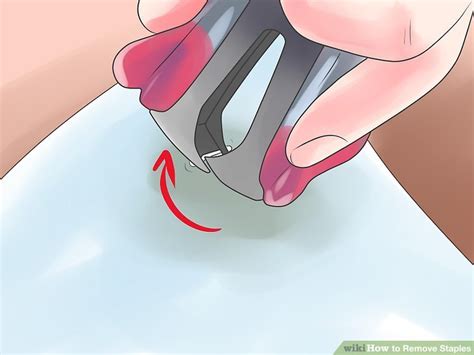 How To Remove Staples 9 Steps With Pictures WikiHow