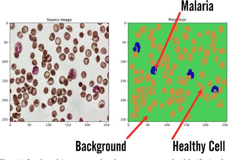 Figure 10 From Malaria Detection Using Advanced Deep Learning Architecture Semantic Scholar