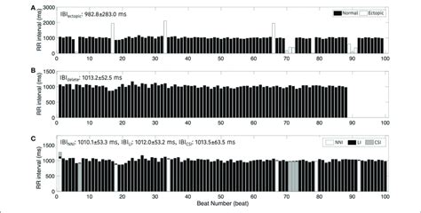 Interbeat Intervals A Including Ectopic Beats B After Removing Download Scientific
