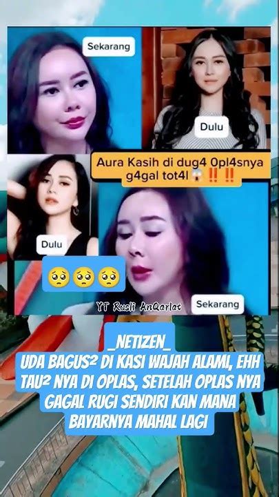 Di Duga Aura Kasih Gagal Oplas Jadi Rugi Sendiri Kan Short Aurakasih