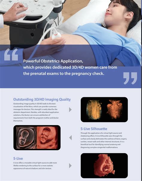 Sonoscape P9 Elite 3d4d Ultrasound Machine Doppler Medical Ultrasound