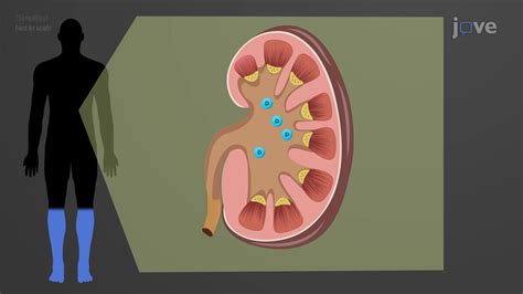 Video Kinetics Of Drug Elimination