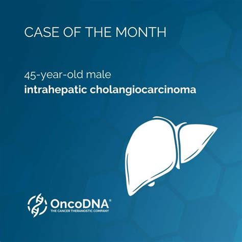 Cholangiocarcinoma Fgfr2 Bicc1 Fusion Identified Oncodna Biosequence