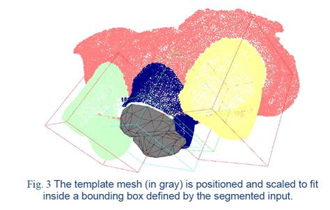 Improving The Quality Of Dental Crown Using A Transformer Based Method