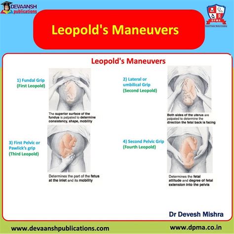 Dr Devesh Mishra 🕉 Leopolds Maneuvers These Are A Common And