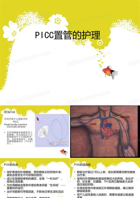 Picc维护ppt模板下载 编号lkpadadw 熊猫办公
