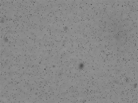 194 Questions With Answers In Ficoll Science Topic