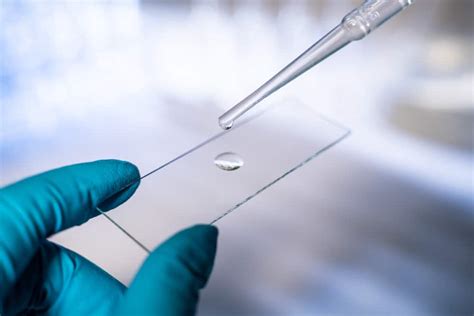 Wet Mount Test Procedure For Vaginitis Paano Dapat Maghanda