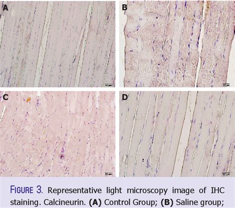 Pdf Comparison Of Linear Versus Macrocyclic Gadolinium Chelates In