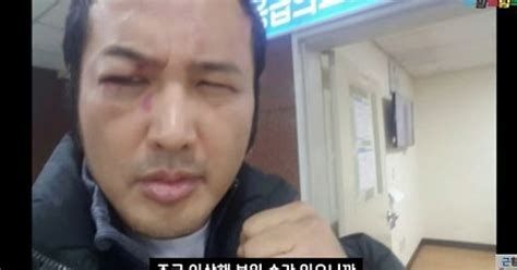 김보성 왼쪽 눈 실명오른쪽 시력도 마이너스 6