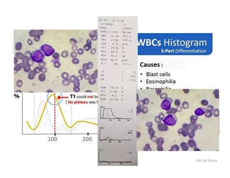 Wbc Histogram Pdf