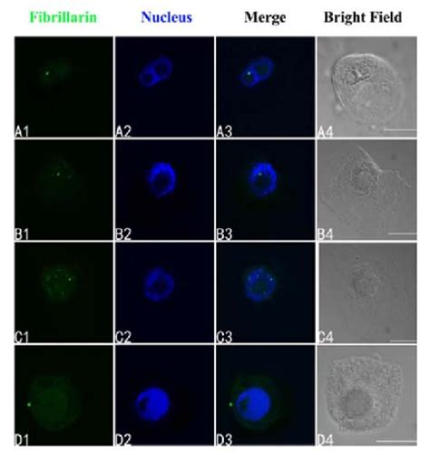 Simultaneous Location Of Fibrillarin After The Reaction With Primary Download Scientific