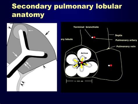 Diffuse Parenchymal Lung Diseases Postgraduate Course PDF Lung And Respiratory Health