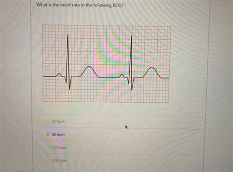 Solved What is the heart rate in the following ECG 나 bpm Chegg com