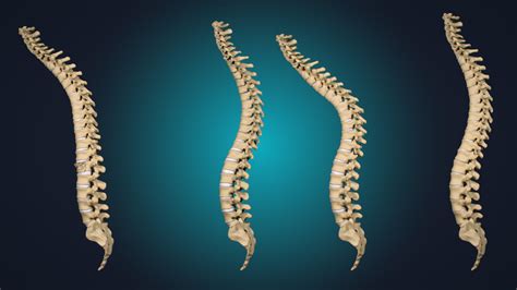 Spinal Deformities And Injuries Image