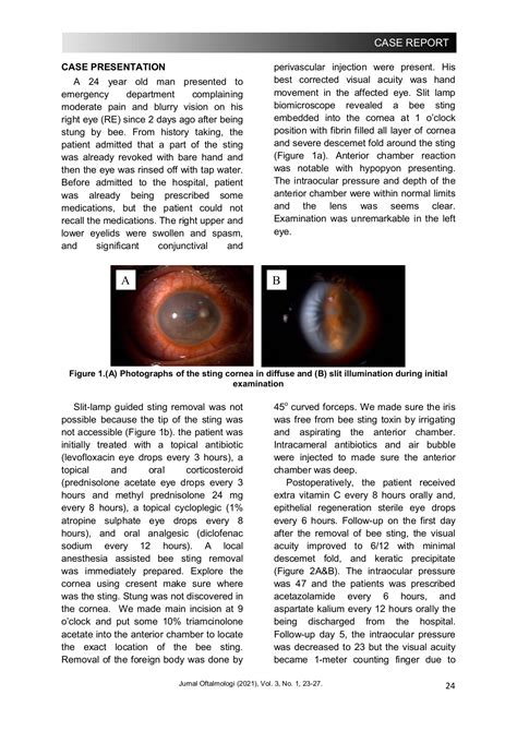 Jurnal Oftalmologi April 2021 Satriawidy Halaman 25 Pdf Online