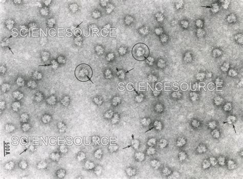 Ribosomes Electron Micrograph Exploring The Cell A Photo Gallery