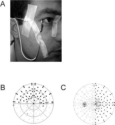 A Photography Of A Subject With Dtl Electrodes Attached The Dtl Download Scientific Diagram