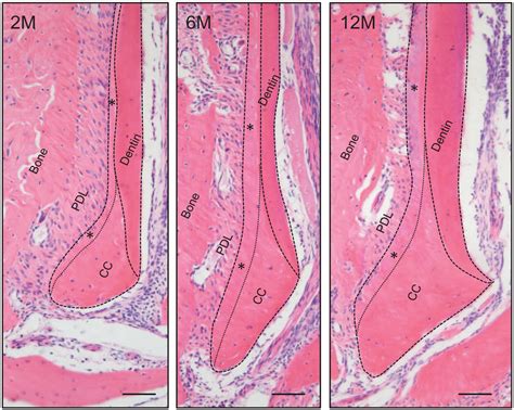 Cementum Histology