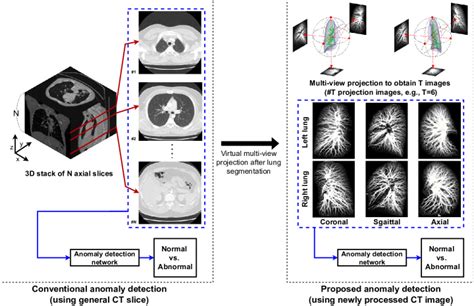 220613385 3d Unsupervised Anomaly Detection And Localization Through