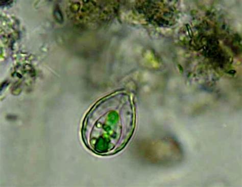 Microscopic Algae